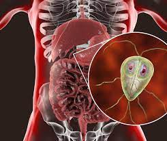 Giardioza - Jakie Szczepionki?